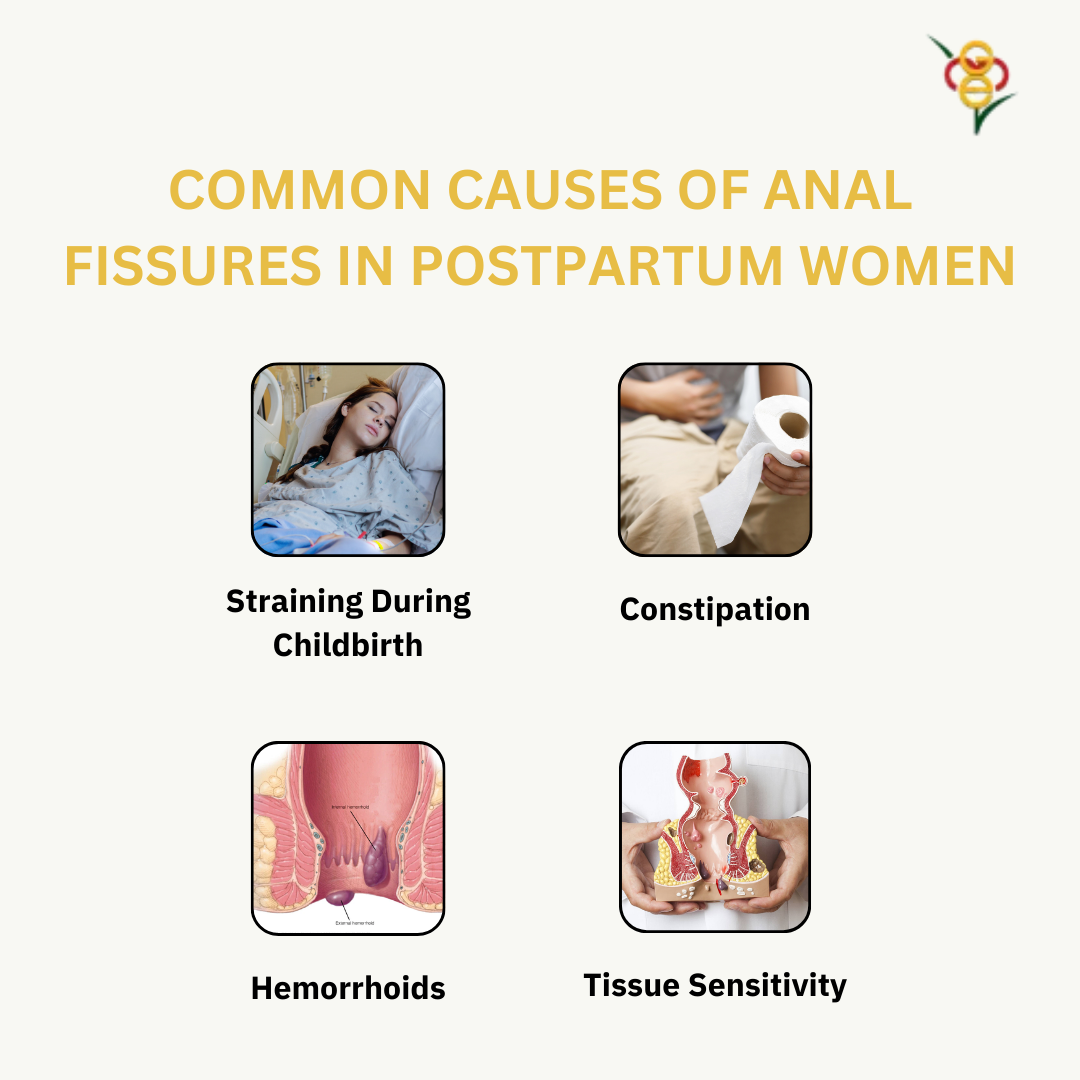 Understanding Anal Fissures in Postpartum Women: Causes and Care Understanding Anal Fissures in Postpartum Women: Causes and Care