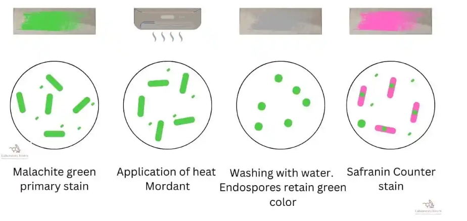Differences between simple and differential staining - LaboratoryIntern Differences between simple and differential staining - LaboratoryIntern